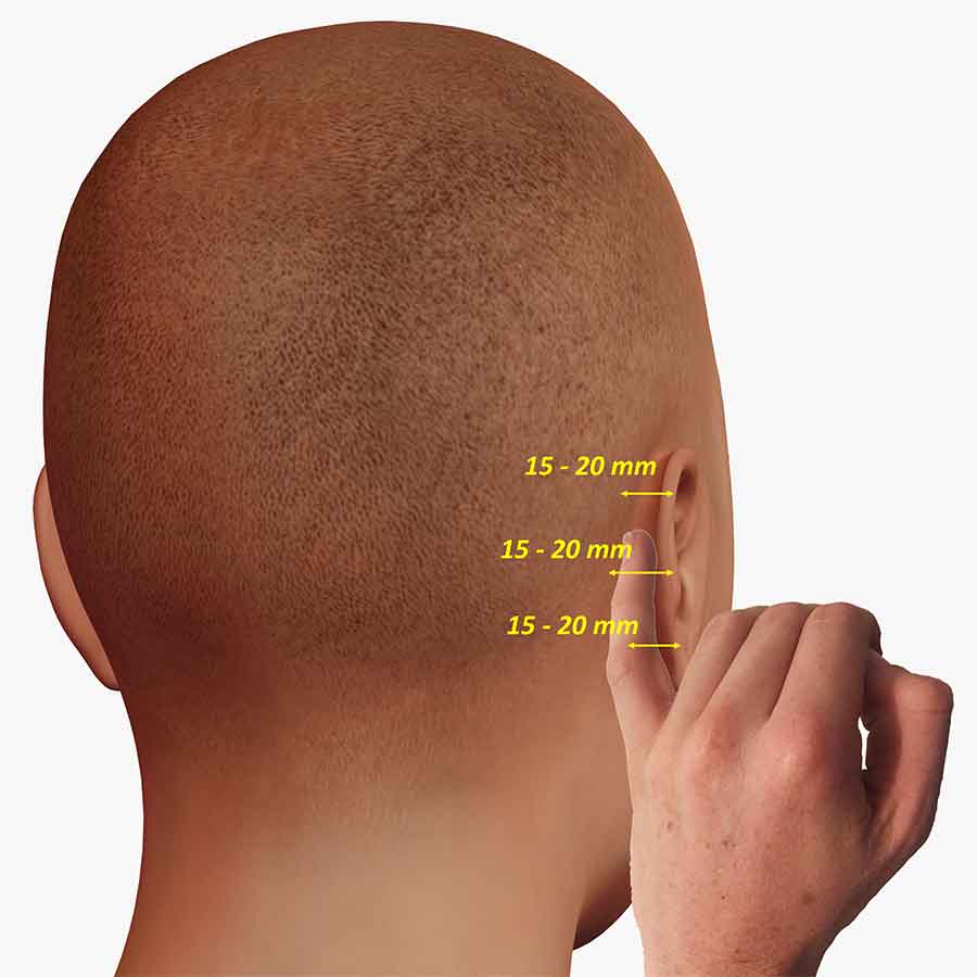 ELROUBY Clinic for Cosmetic Procedures, Hair transplantation and LASER ...